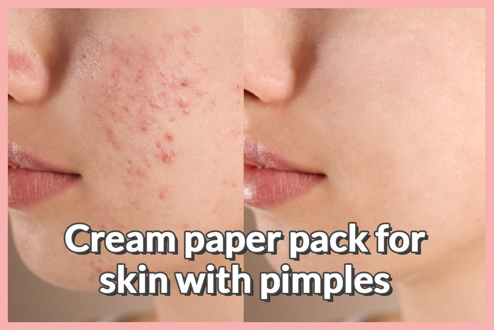 Fight against the comedonal acne! Cream paper pack for skin with pimpl ...